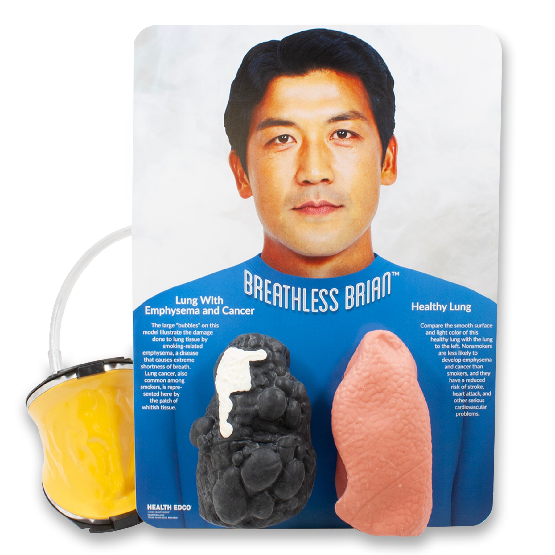 Breathless Brian™ Smoker’s Lungs Model | Health Edco