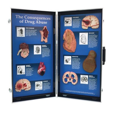 Drug Identification Guide For Health Education | Health Edco