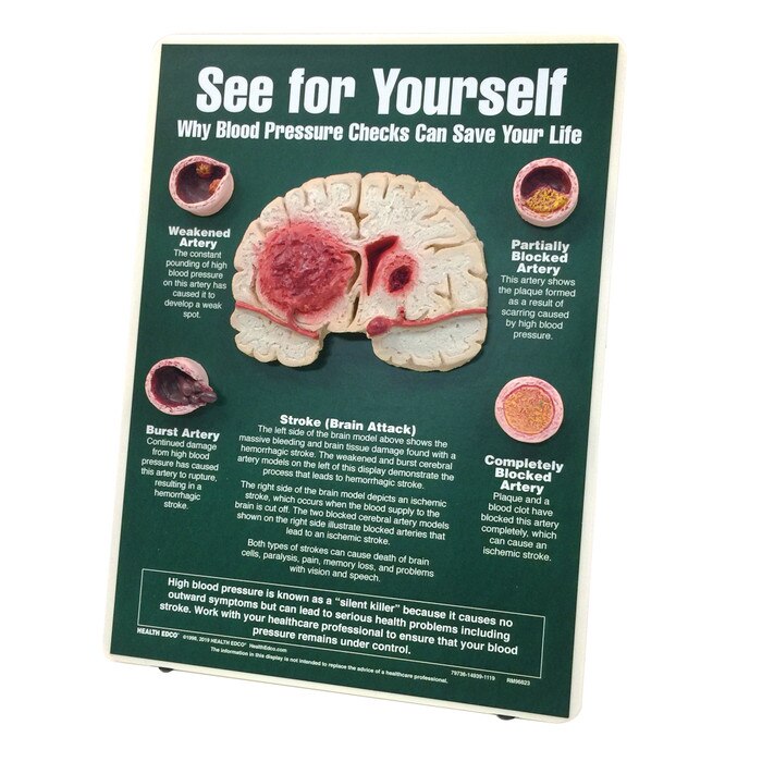 Blood Pressure Checks Easel Display Health Edco blood-pressure-checks-easel-display-health-edco