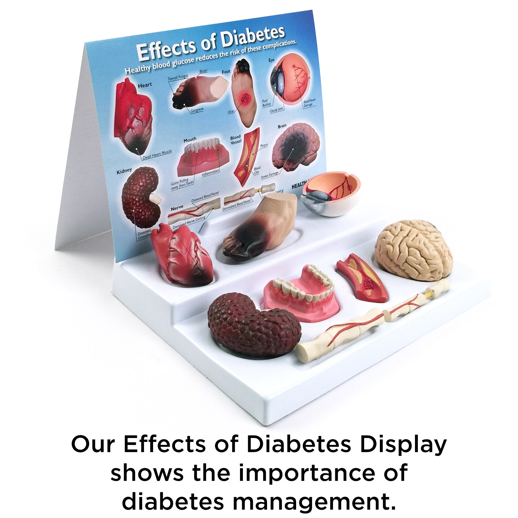 Time in Range for Diabetes Management | Health Edco