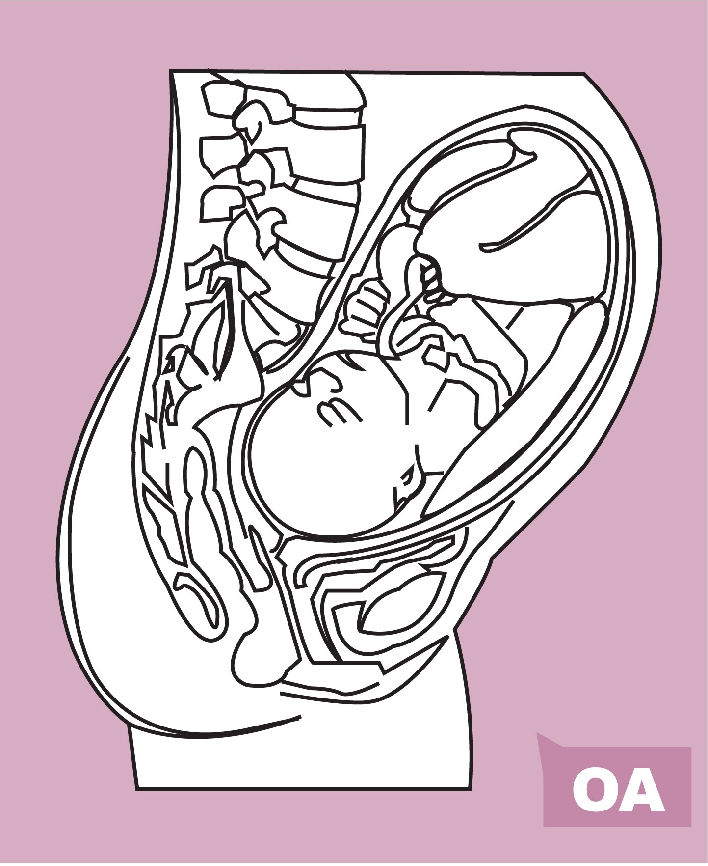 Dealing With Back Pain During Labor | Childbirth Graphics