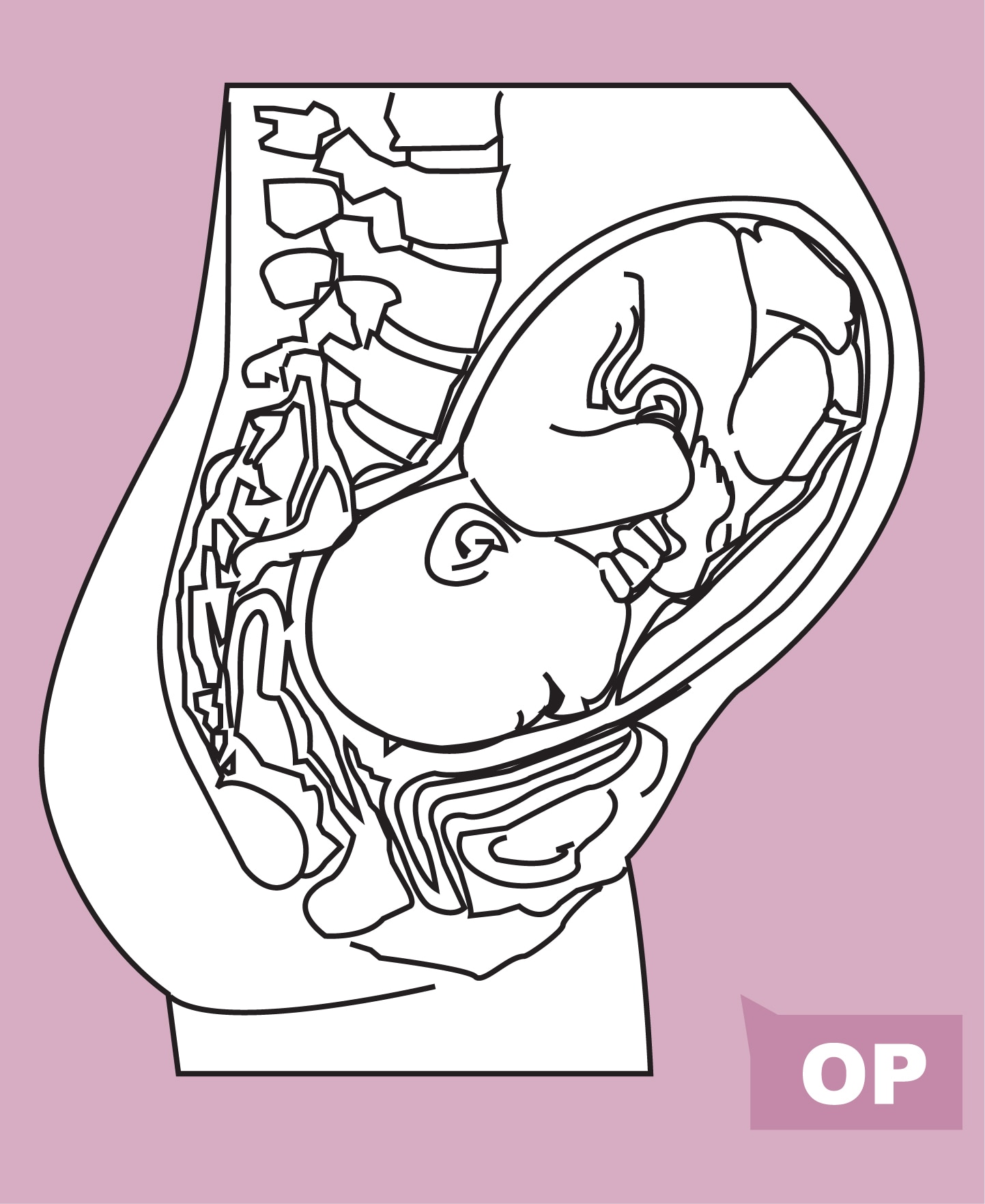 Dealing With Back Pain During Labor | Childbirth Graphics